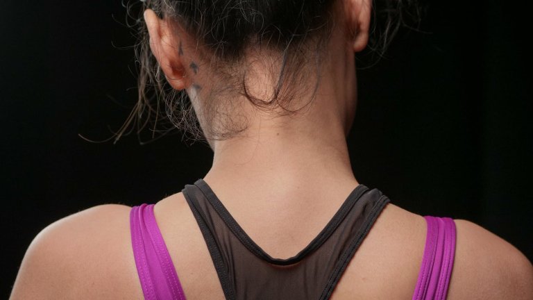 10 Best Neck Hump Exercises to Improve Posture Naturally