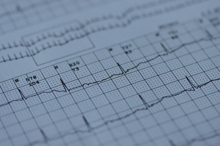 Heart Rate Chart for Seniors: Resting Pulse Ranges and When to Worry