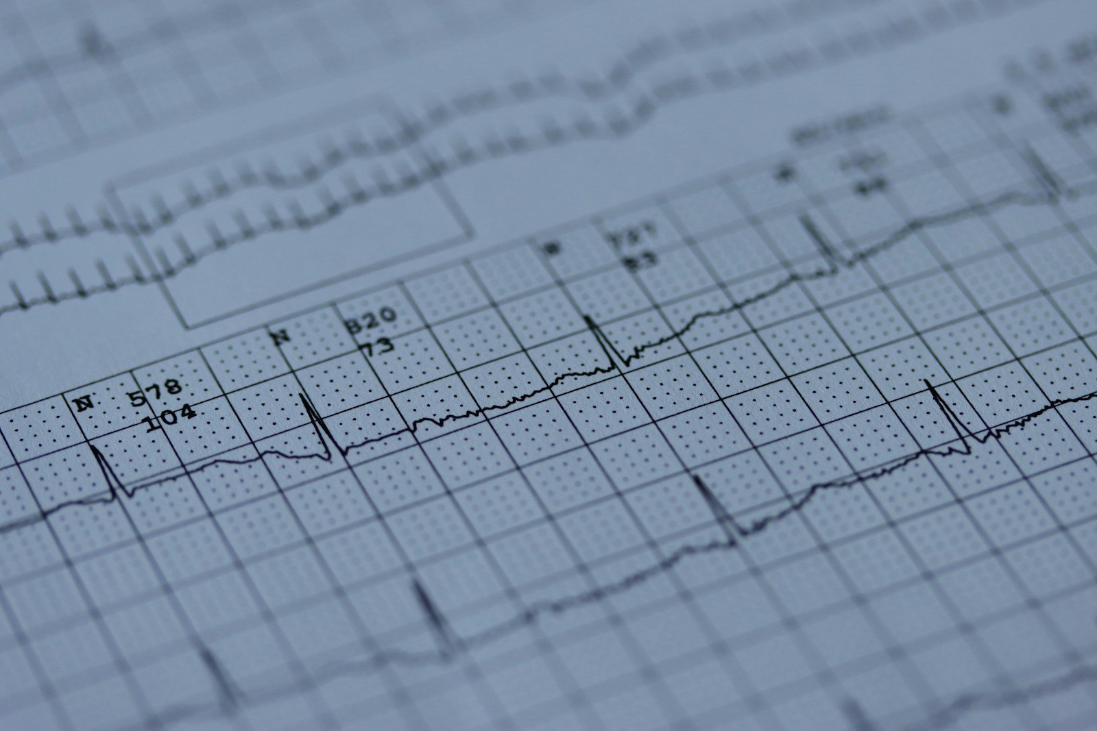 Heart Rate Chart for Seniors: Resting Pulse Ranges and When to Worry